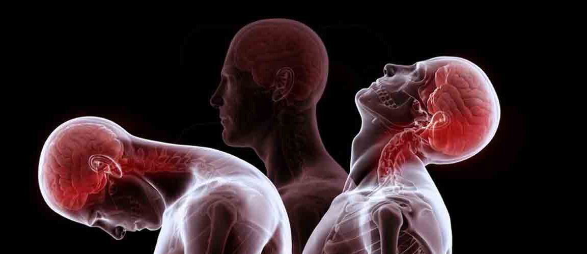 A Simple Way To Prevent Whiplash Neck Injuries | The Orthopaedic ...